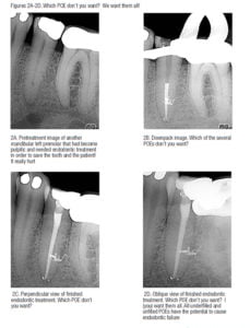 “What’s It All About?” Part 7 - Endodontic Practice US - Dental Journal ...