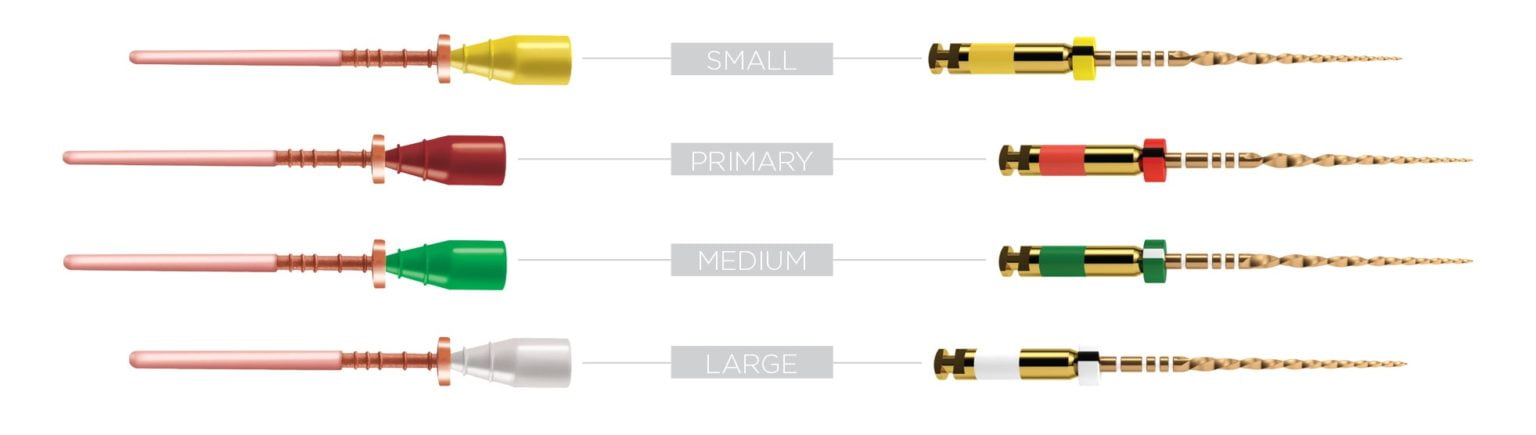 Endodontic News - Dentsply Sirona Endodontics Introduces GuttaCore ...