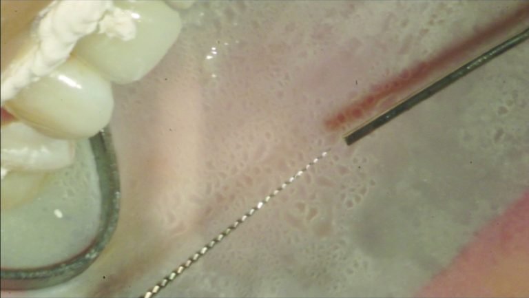 The foundation of minimally invasive endodontics: research, technology ...