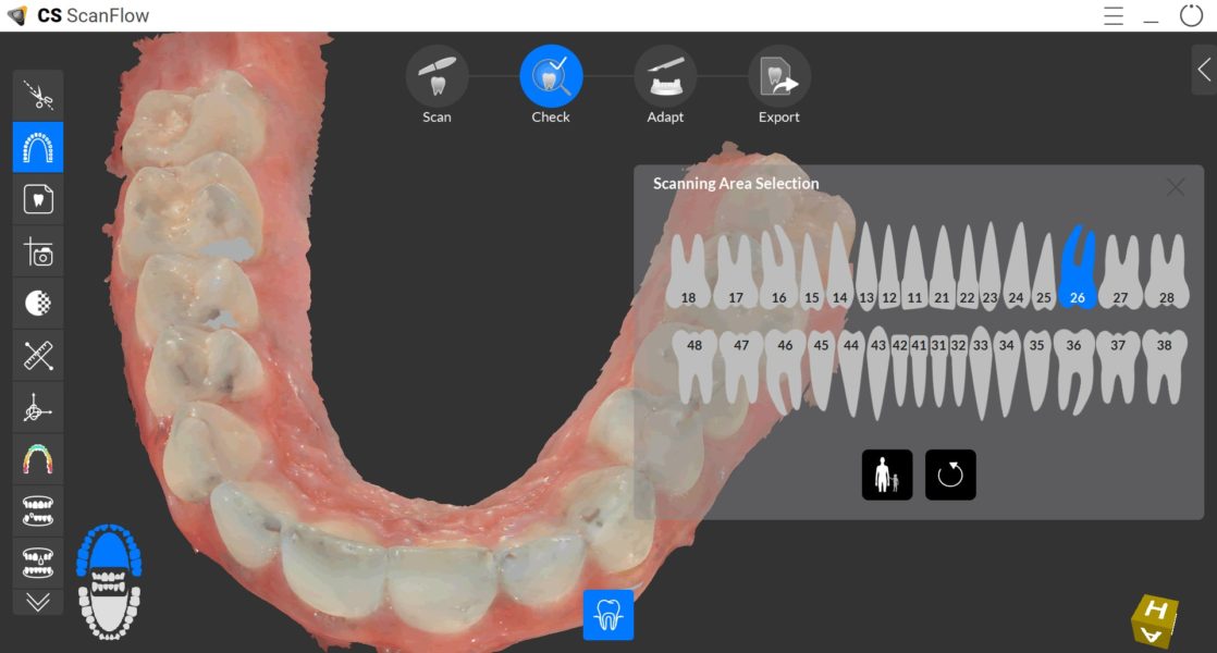 Endodontic News - Latest Innovation from Carestream Dental Help Doctors ...