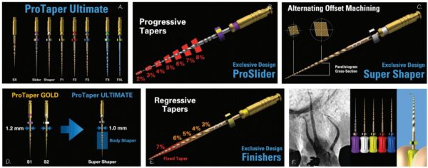 ProTaper Ultimate — the go-to endodontic-preparation rotary system