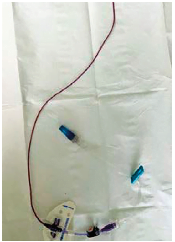 Sepsis — dentists can recognize the signs