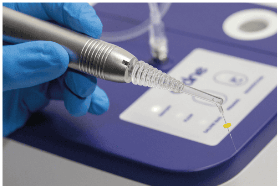 Odne — bringing endodontic innovations to the US